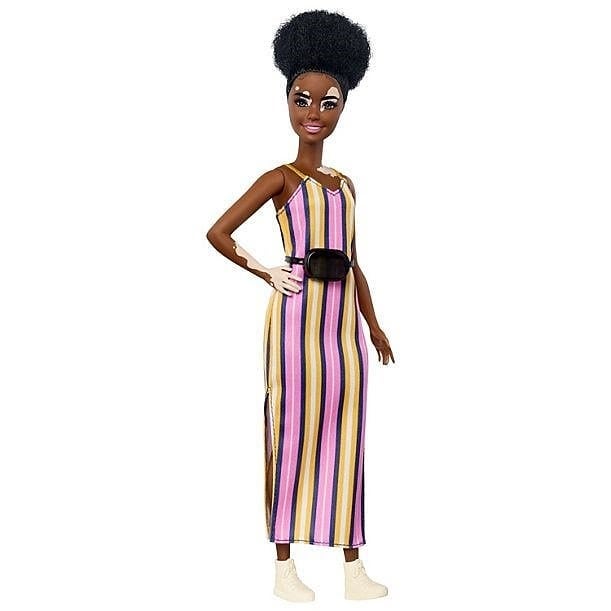 A New Range of Diverse Barbie Dolls includes Dolls with Vitiligo and a ...